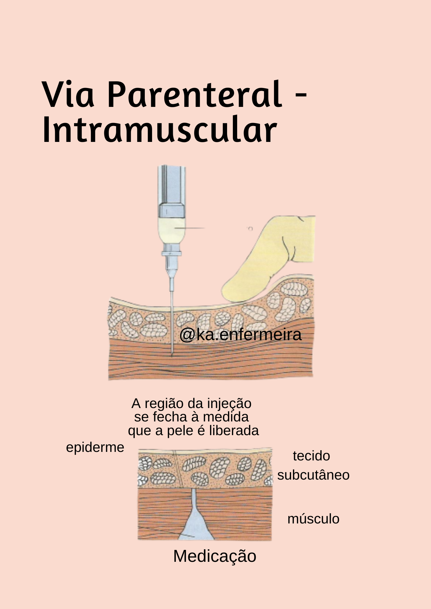 Z-track ( Via intramuscular) - Farmacologia I