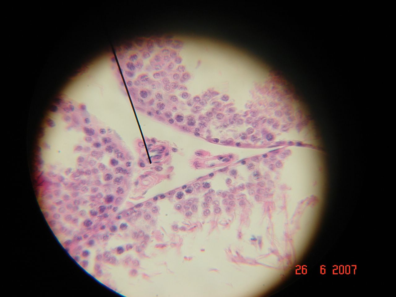 Testiculo - HE 2 (célula de leydig) [1280x768] - Histologia e ...