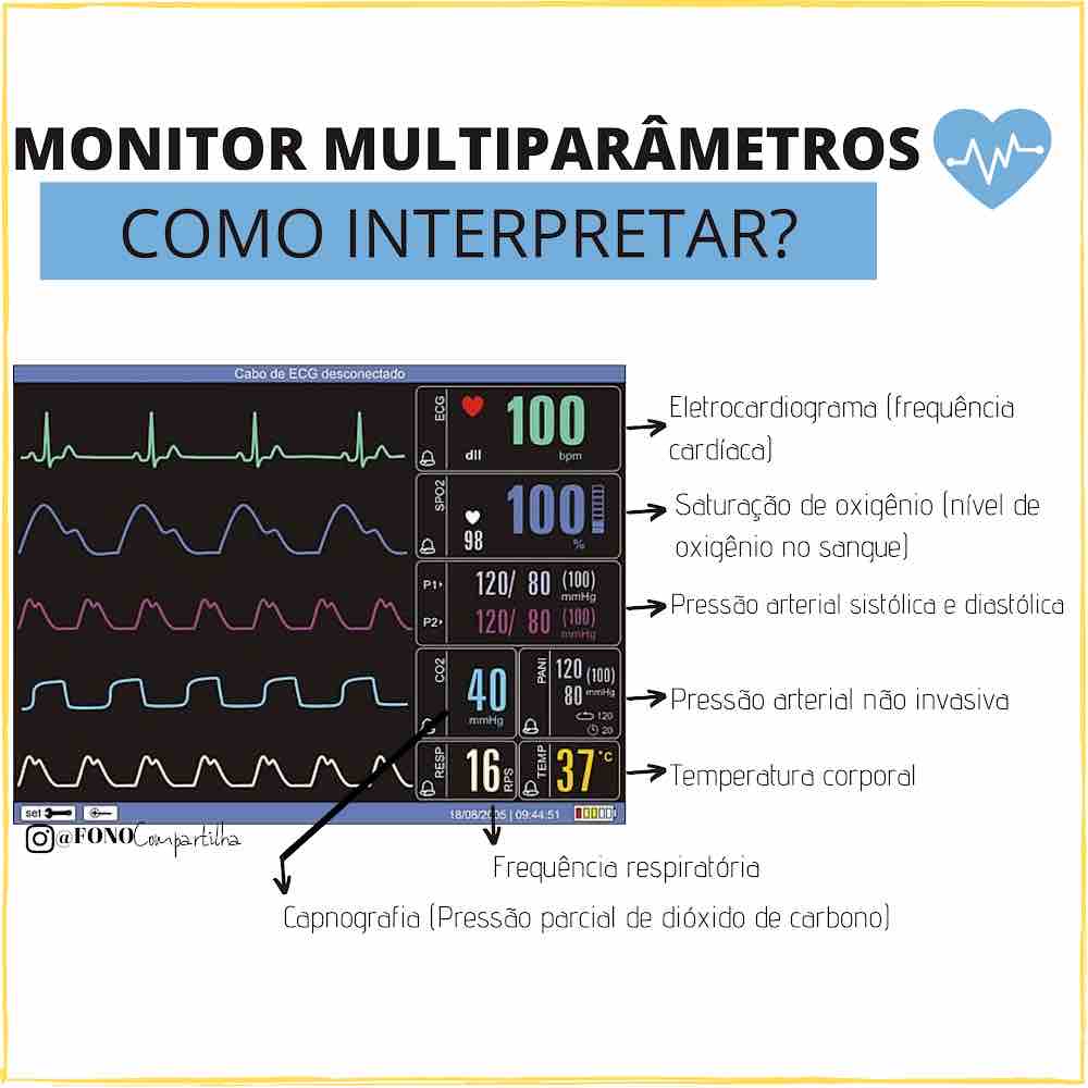 monitor multiparâmetros - Fonoaudiologia Hospitalar