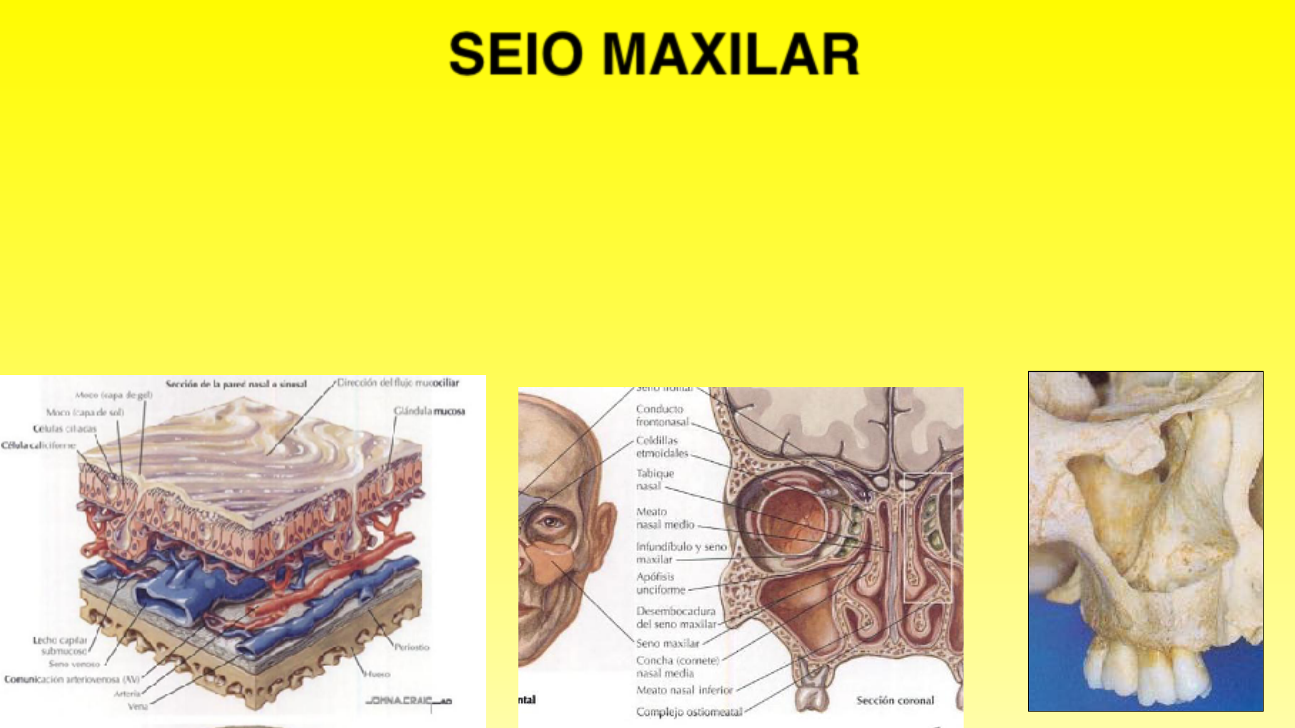 doencas odontogenicas - Cirurgia