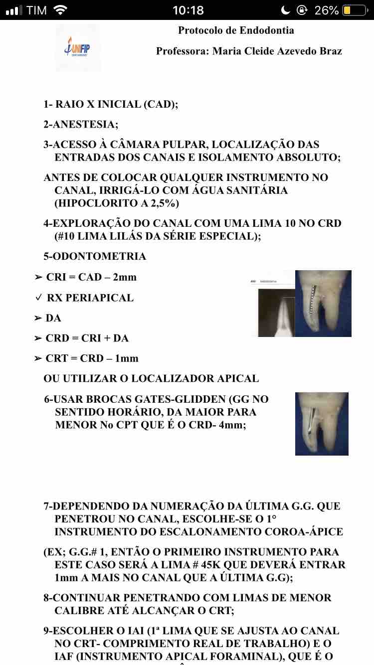 passo a passo endo - Endodontia