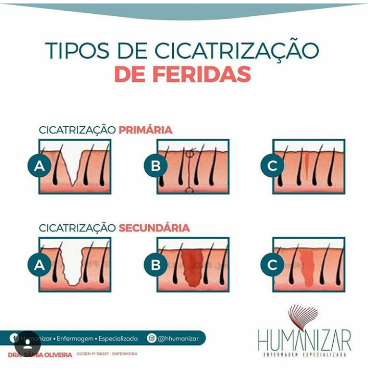 Tipos de cicatrização de feridas - Semiologia e Estomatologia