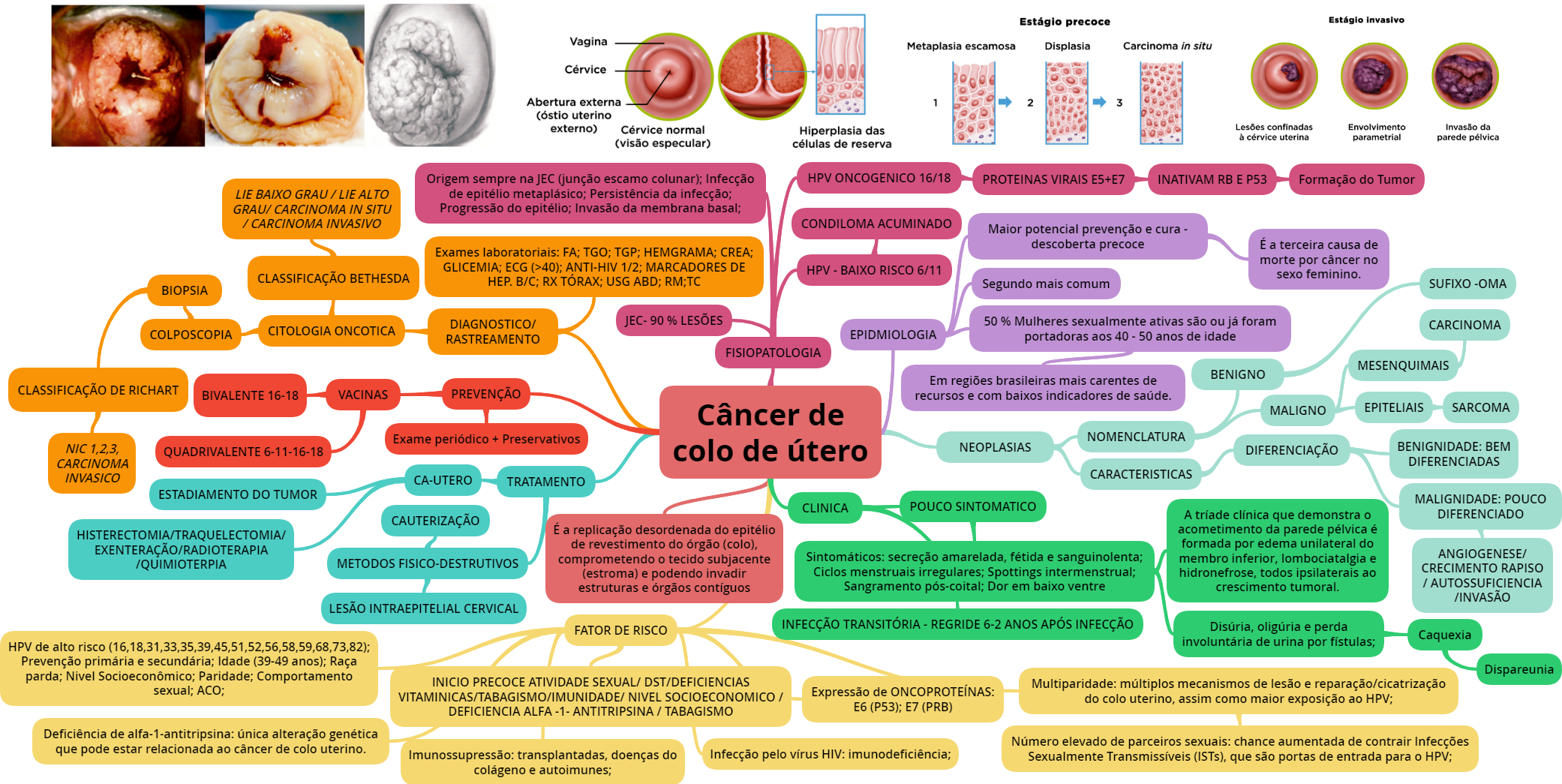 Câncer de colo de útero - Clínica Integrada I