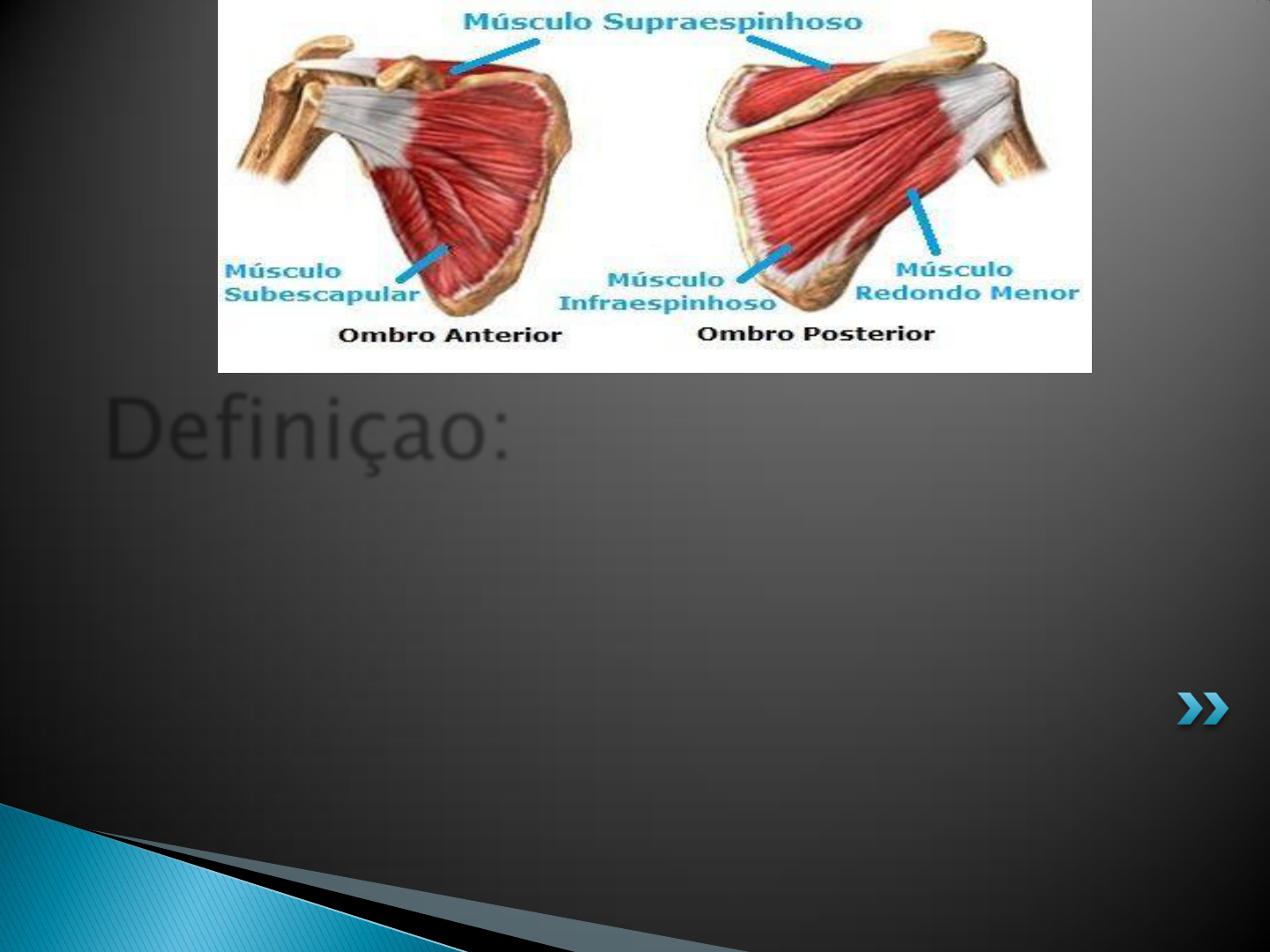 Ruptura do manguito rotador do ombro - Ortopedia