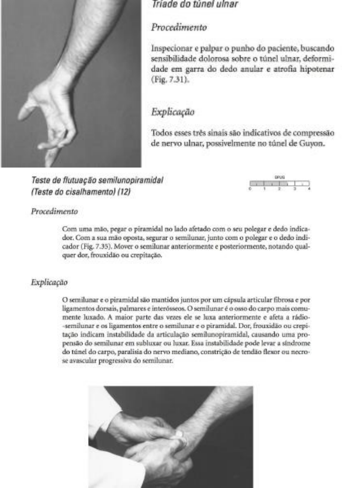 TESTES ORTOPEDICOS DO PUNHO - Fisioterapia