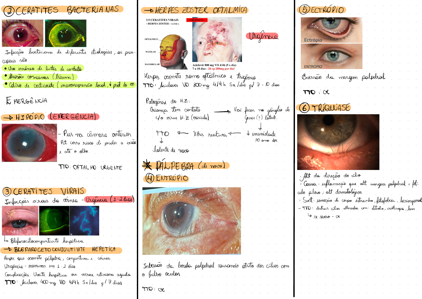 Olho Vermelho Termo Tecnico - BRAINCP