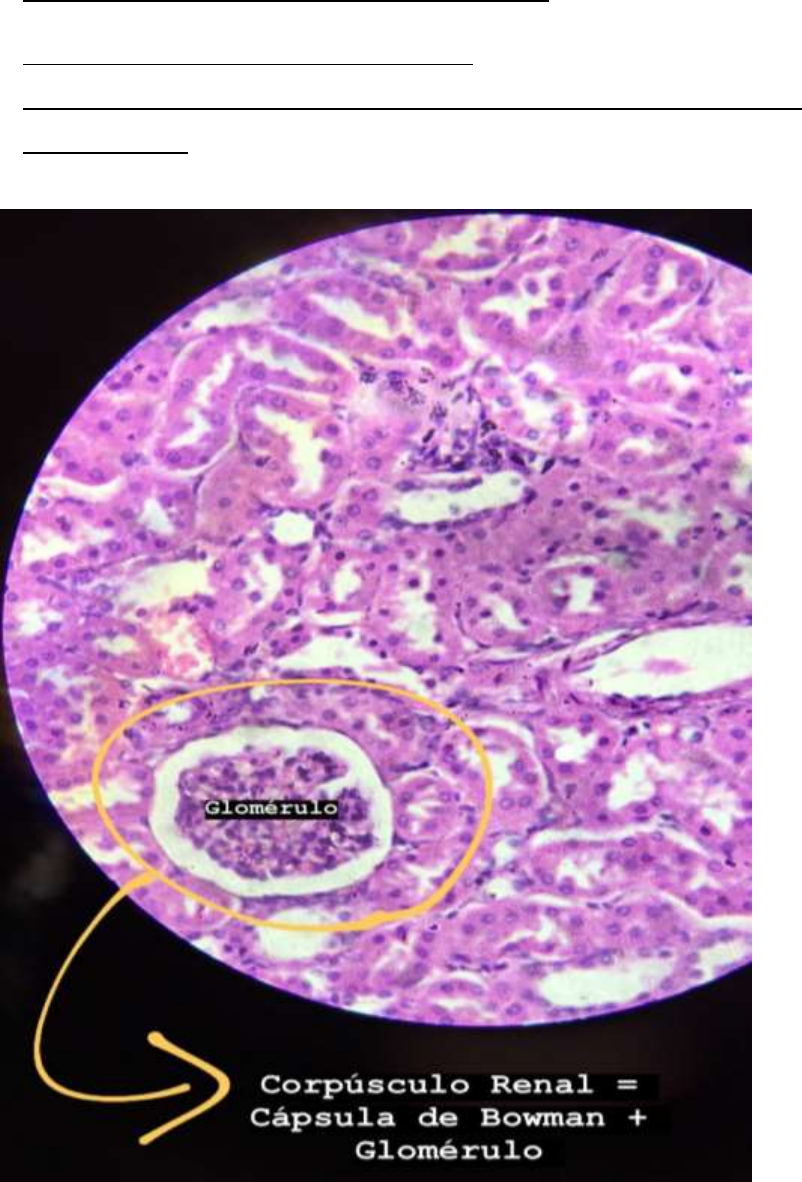 Histologia Do Corpusculo Renal Histologia Do Rim: Néfron, Glomérulo,