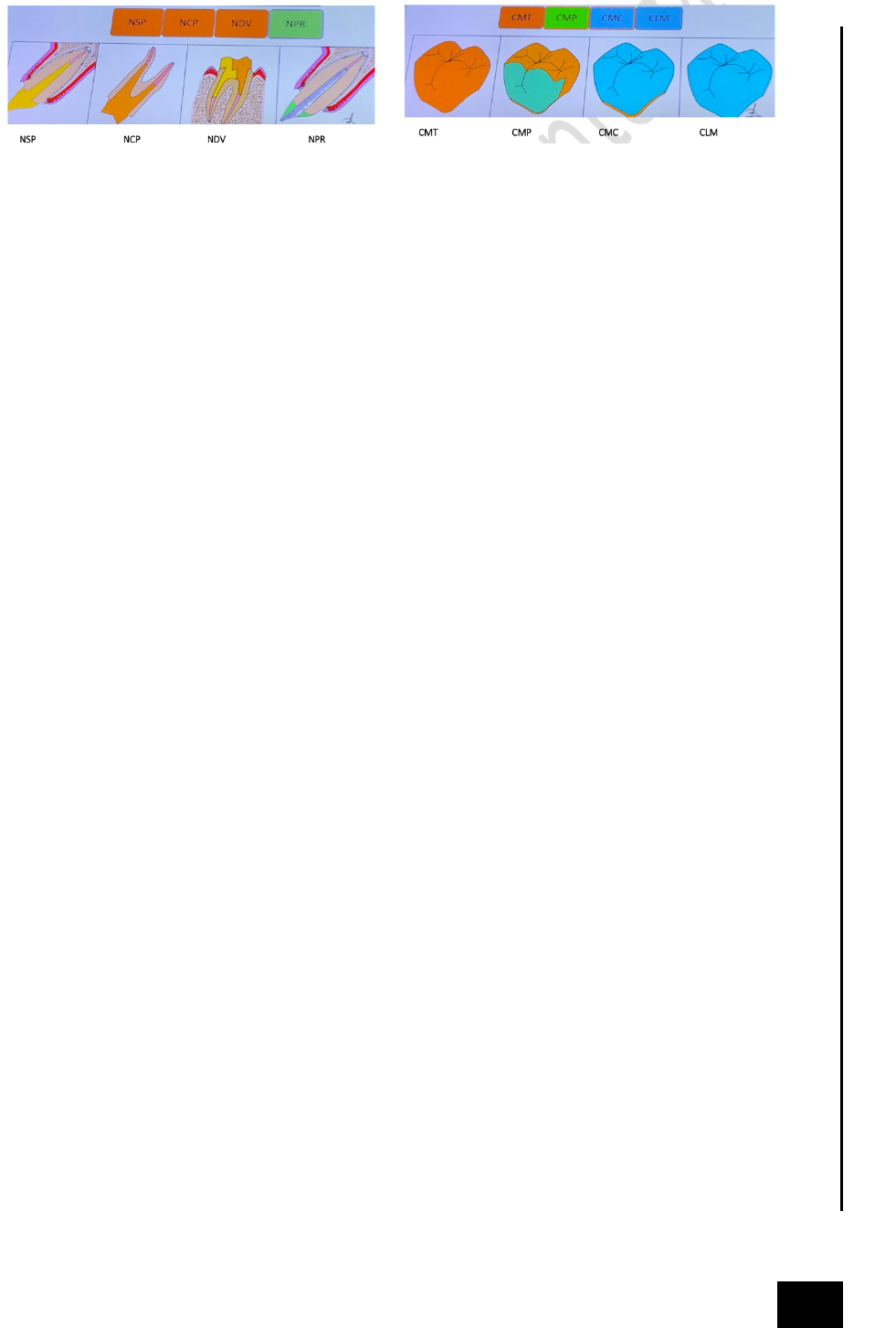 Prótese fixa - Prótese Fixa