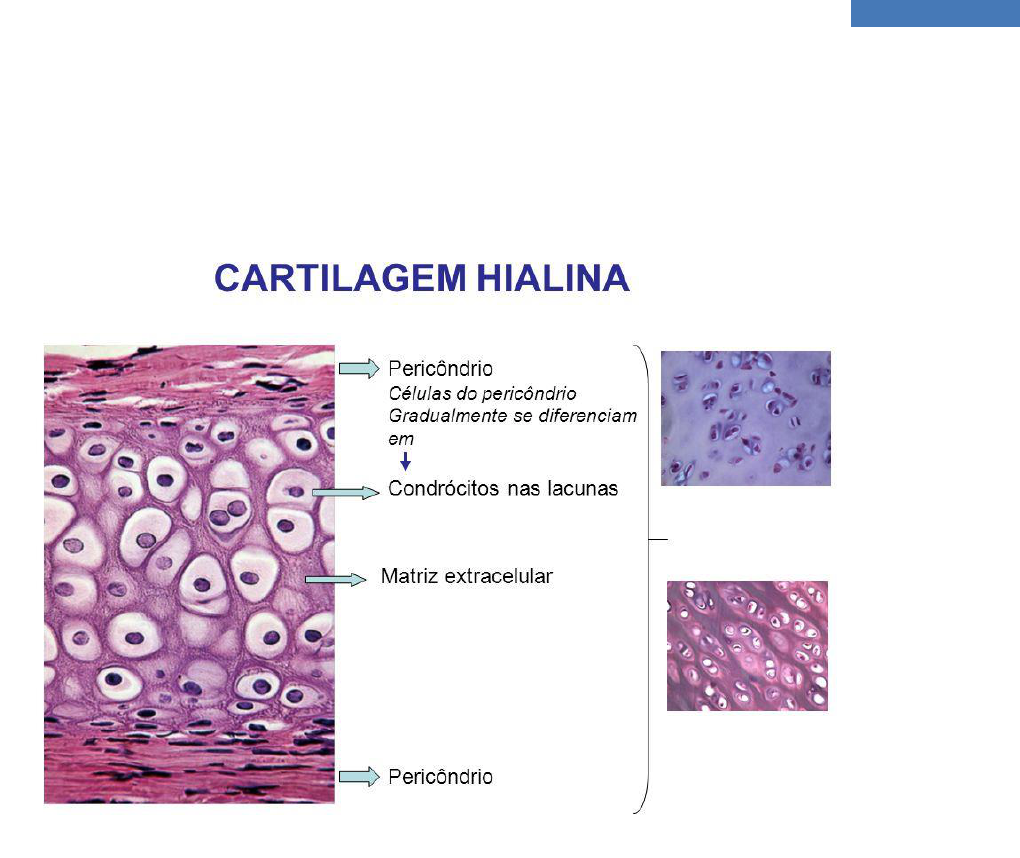 Diagrama De Tecido De Cartilagem Hialina Atlas Histologia