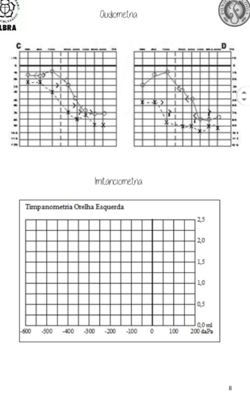 exemplos auiometria e timpanometria - Audiologia