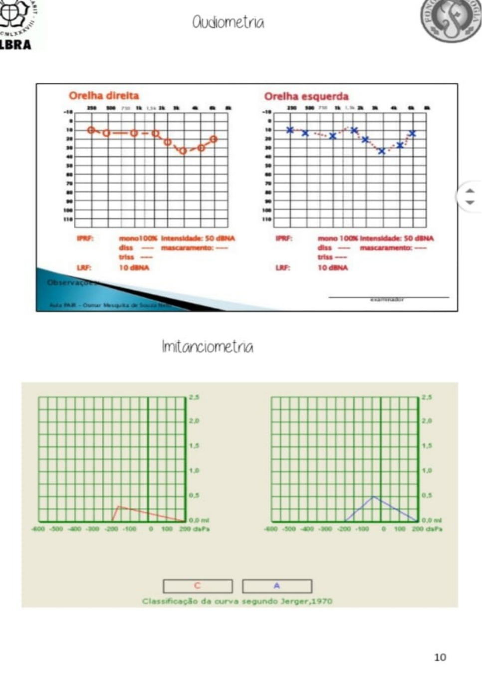 exemplos auiometria e timpanometria - Audiologia