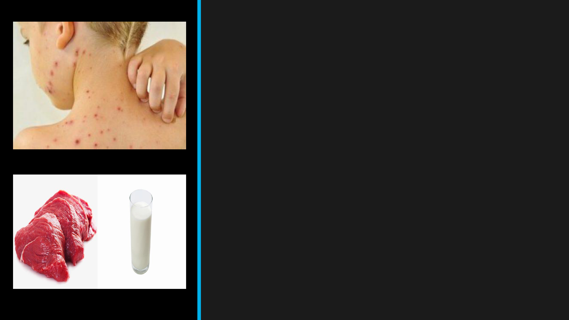 Staphylococcus Aureus - Microbiologia