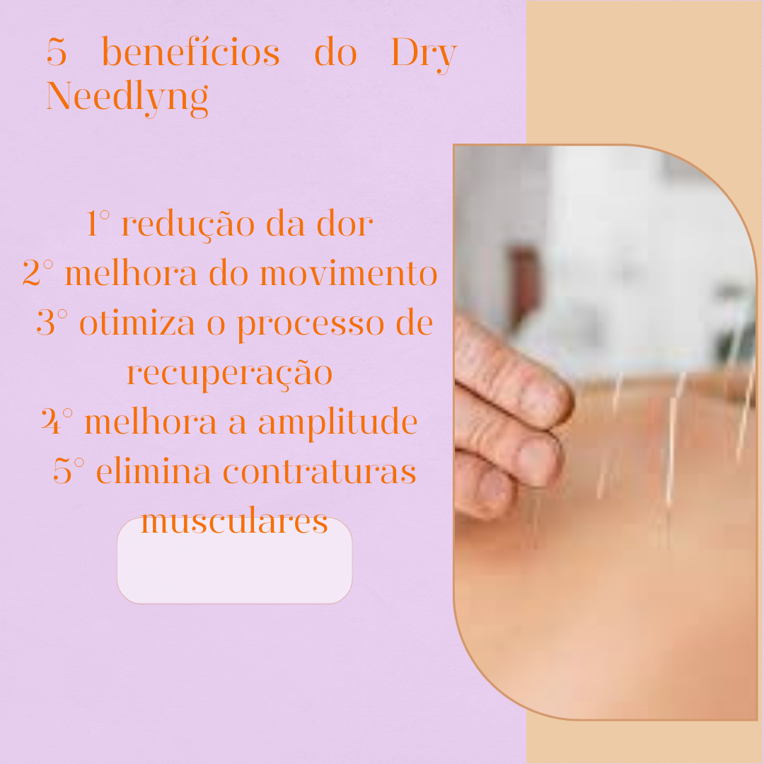 benefícios do Dry Needlyng - Recursos Terapêuticos Manuais