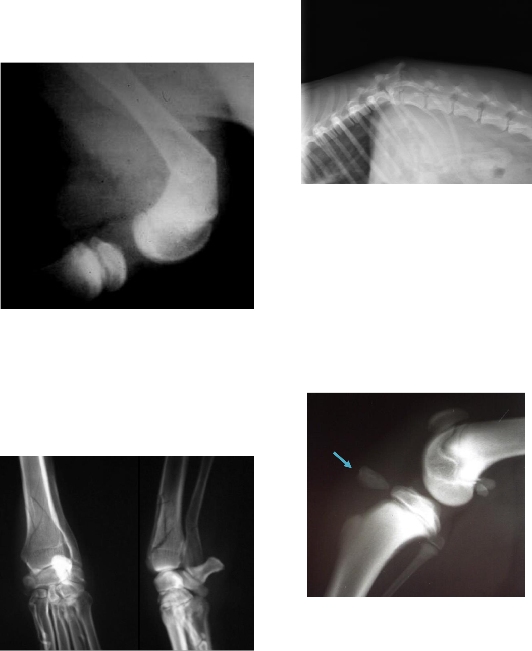 3 AFECÇÕES DO SISTEMA OSTEOARTICULAR - Diagnóstico por Imagem