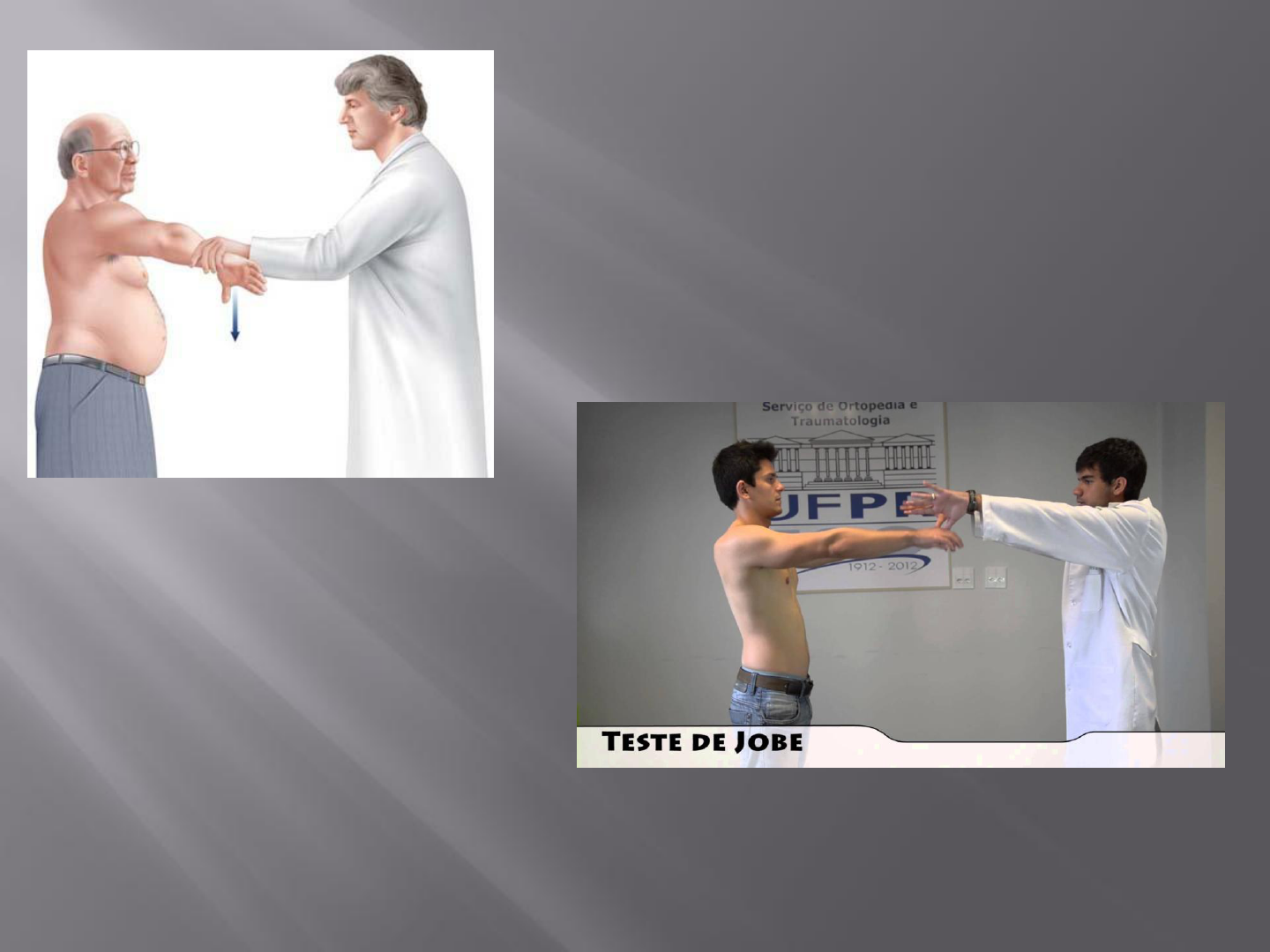 Manguito Rotador – Anatomia, Causas e Avaliação – Dr. Jum Yamamoto