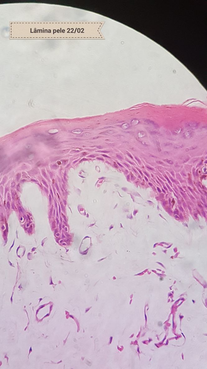 Lâmina da pele - Histologia I