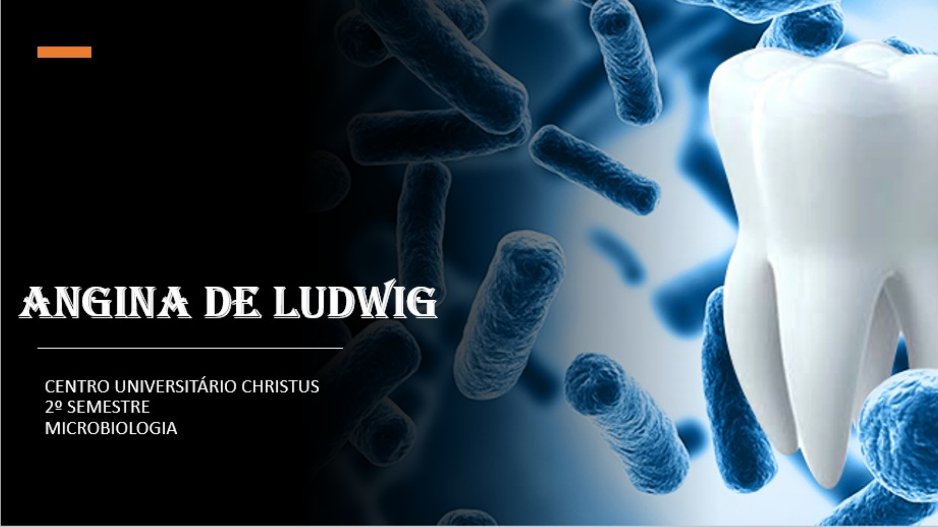 Angina de Ludwig - Anatomia de Cabeça e Pescoço