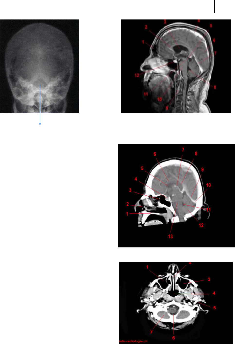 Crânio e Cérebro- Radiologia básica - Imaginologia