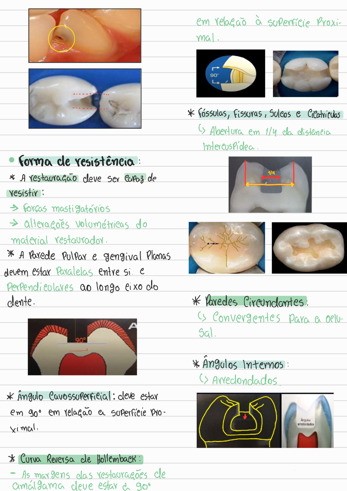 Preparo Cavitário - Dentística