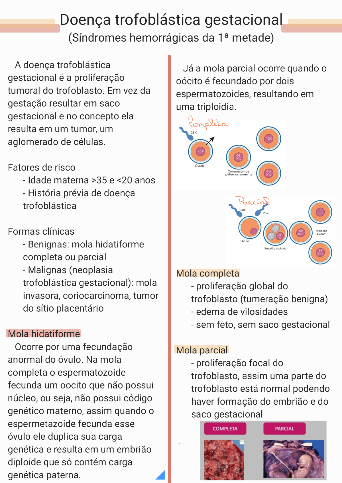 Doença trofoblástica gestacional - Obstetrícia