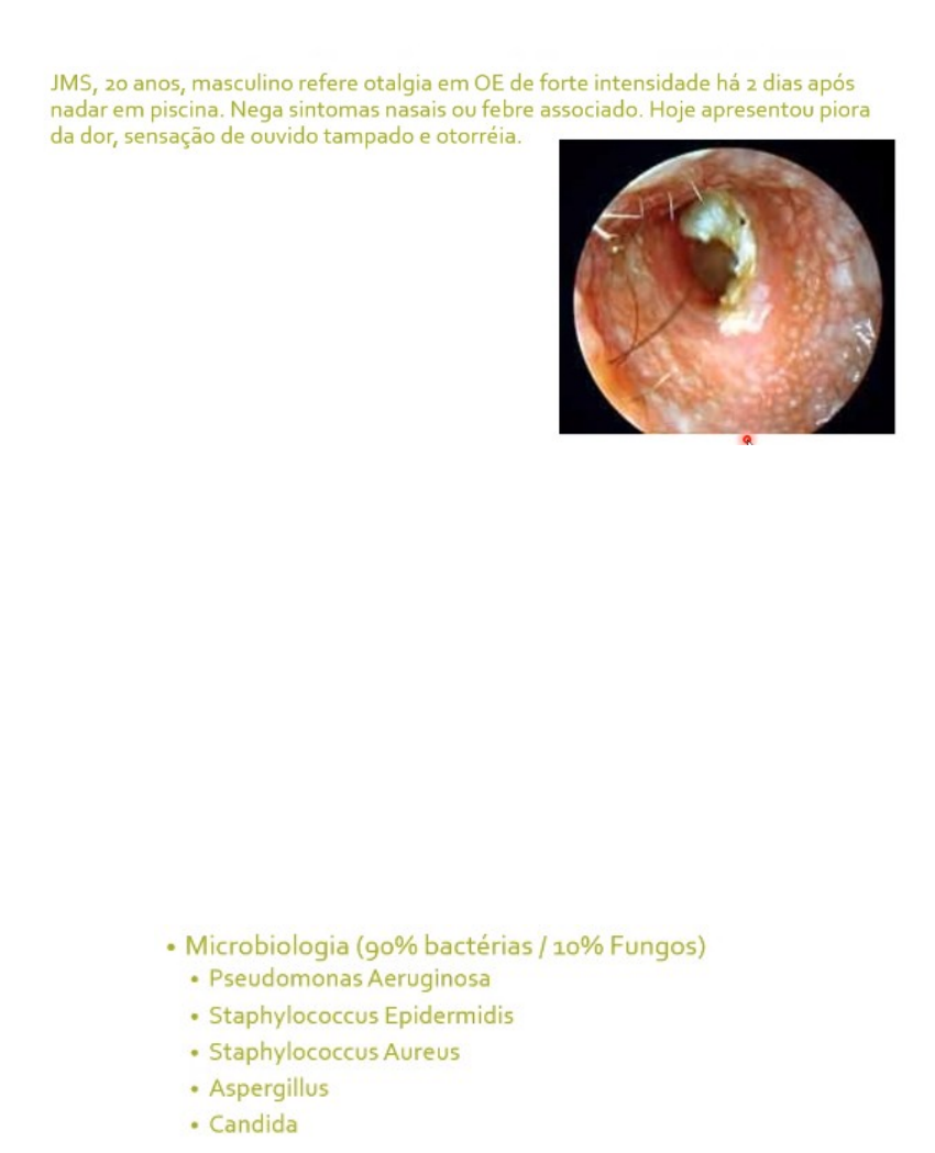 Otite Externa Da Membrana Timpanica Otite Externa E Média Prática