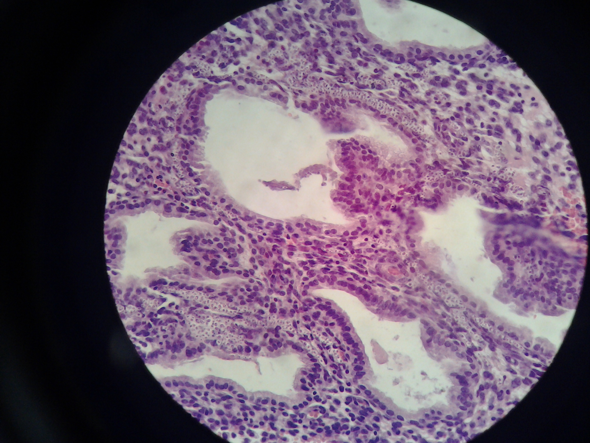 Lâmina do endométrio - Objetiva 10x - Embriologia