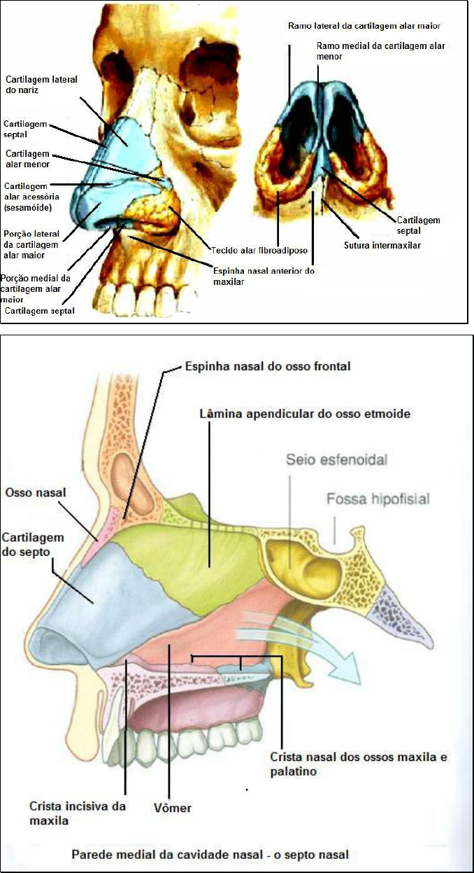 Caso 2.3 - desvio de septo - Anatomia da Cabeça e Pescoço