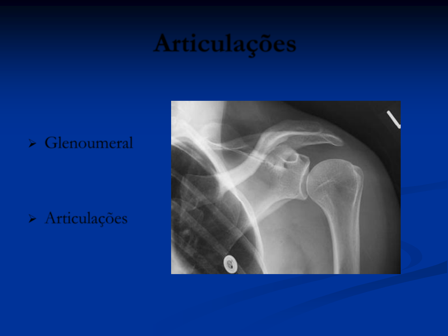 OMBRO imagens (2) - Estudos de Exames por Imagem