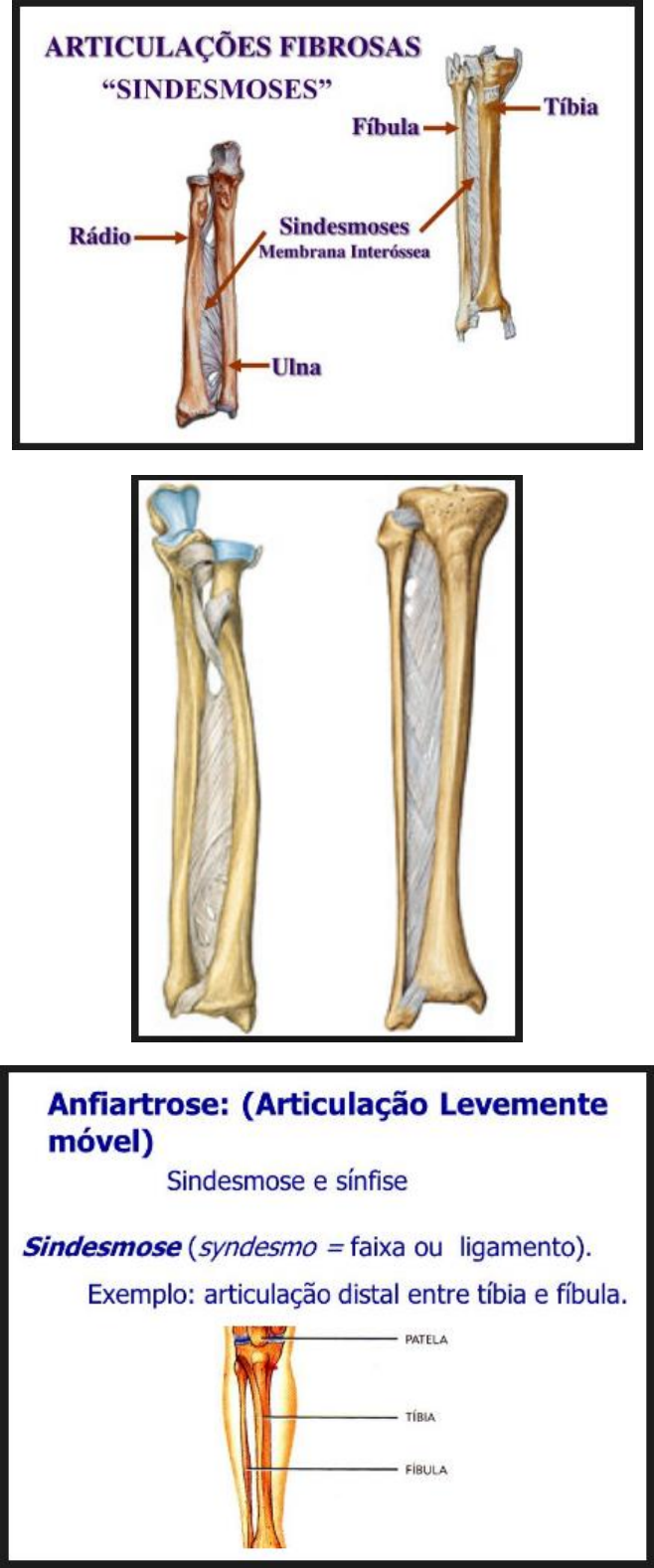 Anatomia Da Articulacao Radioulnar Distal Ossos Rádio E Ulna