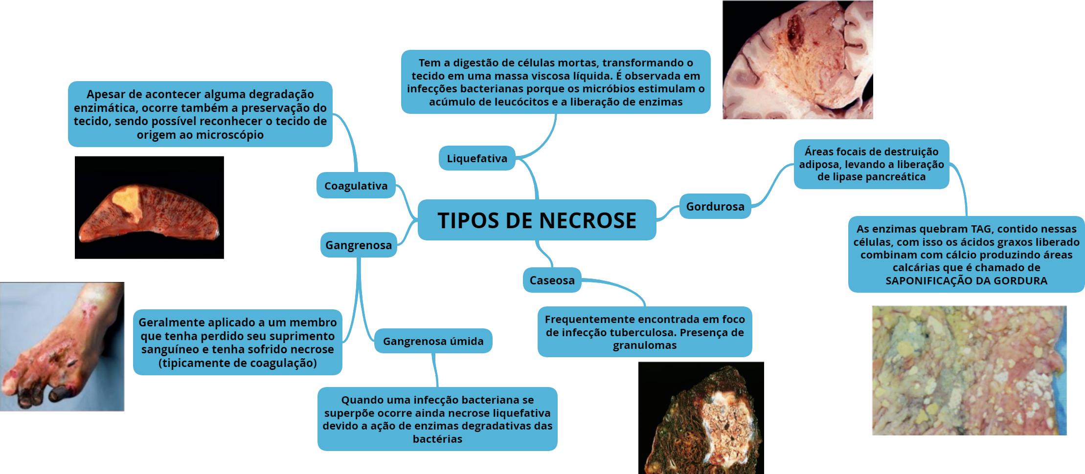 TIPOS DE NECROSE - Patologia I