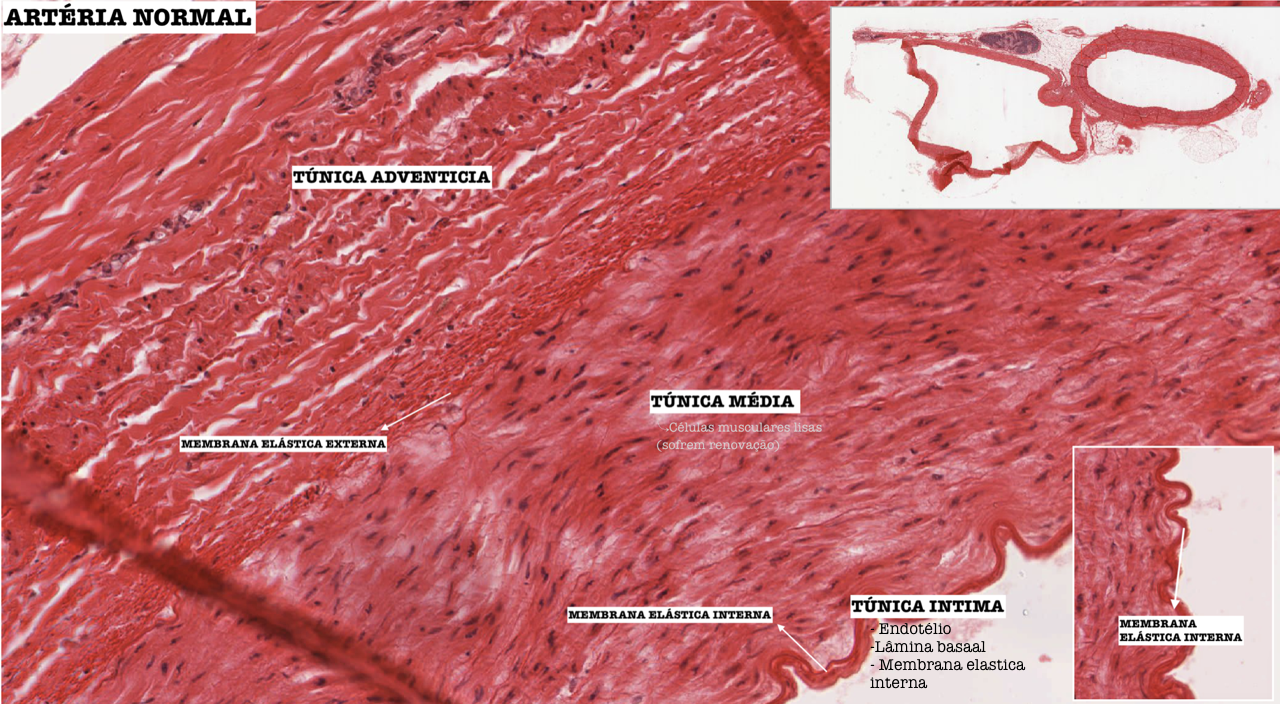 ARTÉRIA NORMAL - Histologia I