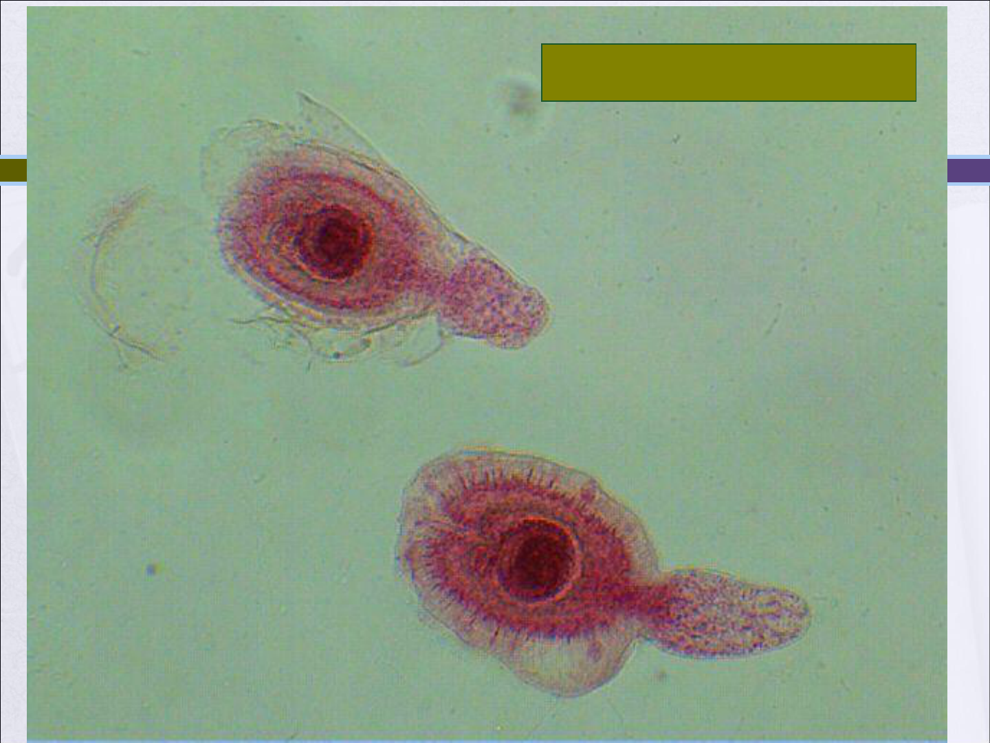 Hymenolepis Nana Cisticercoide