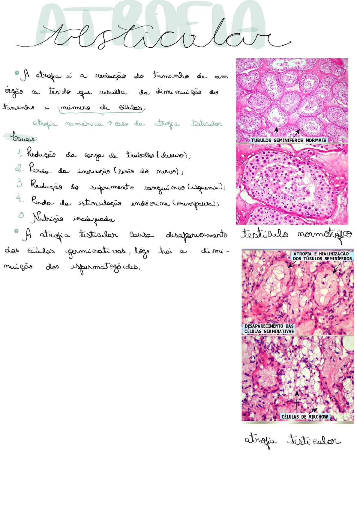 Atrofia testicular - Patologia I