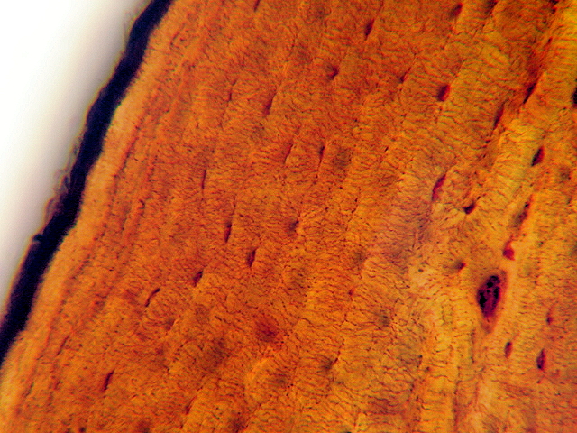 Lâmina 26 5 (lamelas concentricas externas) (canalículos) - Bioquímica ...