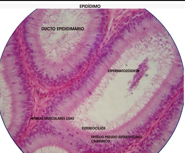 Lamina Do Epididimo Rotulada Anatpat UNICAMP