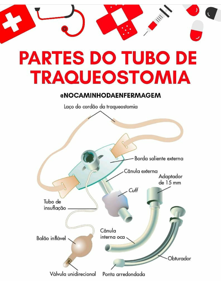Pecas Do Tubo De Traqueostomia