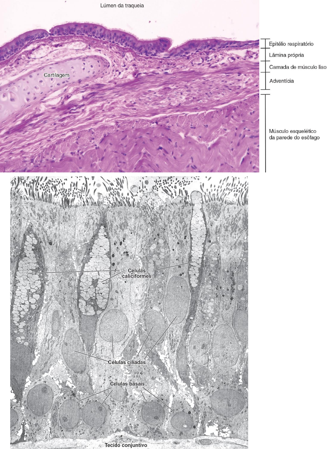 Lamina De Microscopio De Traqueia Musculo Liso Prácticas De