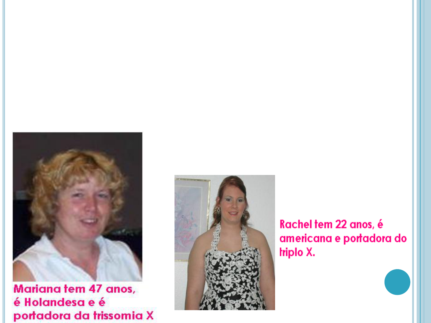 Pessoas Com Sindrome Do Triplo X Síndromes Cromossômicas E Suas