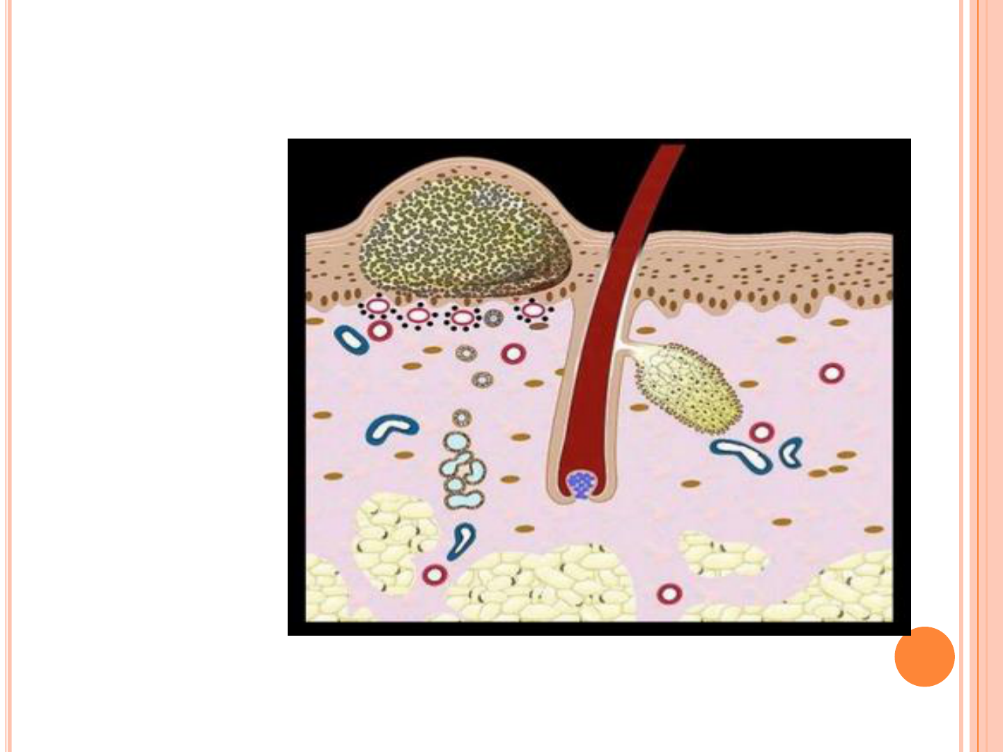 Piodermatites bacterianas superficiais - Clinica Veterinaria de ...