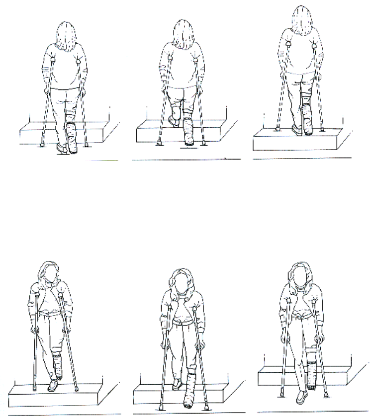 Apostila de treinamento da marcha - Fisioterapia em Ortopedia e ...