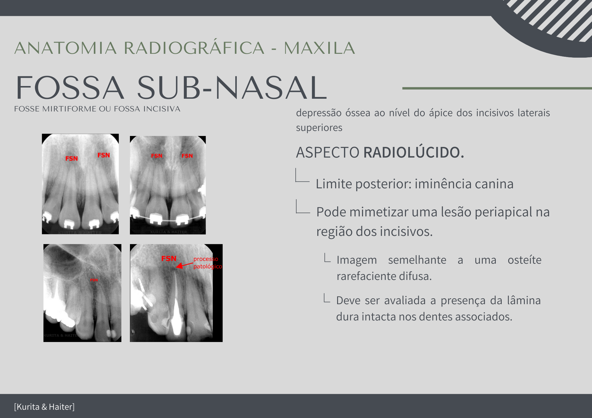 Radiografia Da Fossa Intercondilar