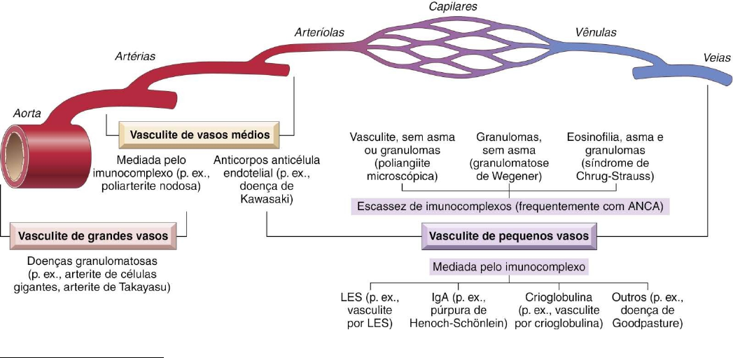 Classificacao De Vasculite Grátis: [RESUMO] VASCULITES DE PEQUENOS