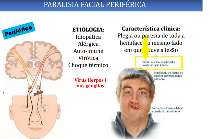 paralisia periferica - Fisiologia Humana I paralisia periferica - Fisiologia Humana I