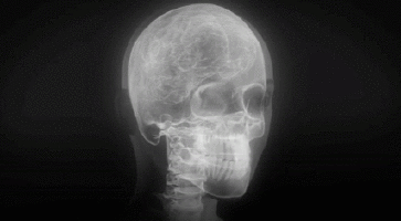 Radiologia: como é o curso, carreira e especialização | Educa Mais Brasil