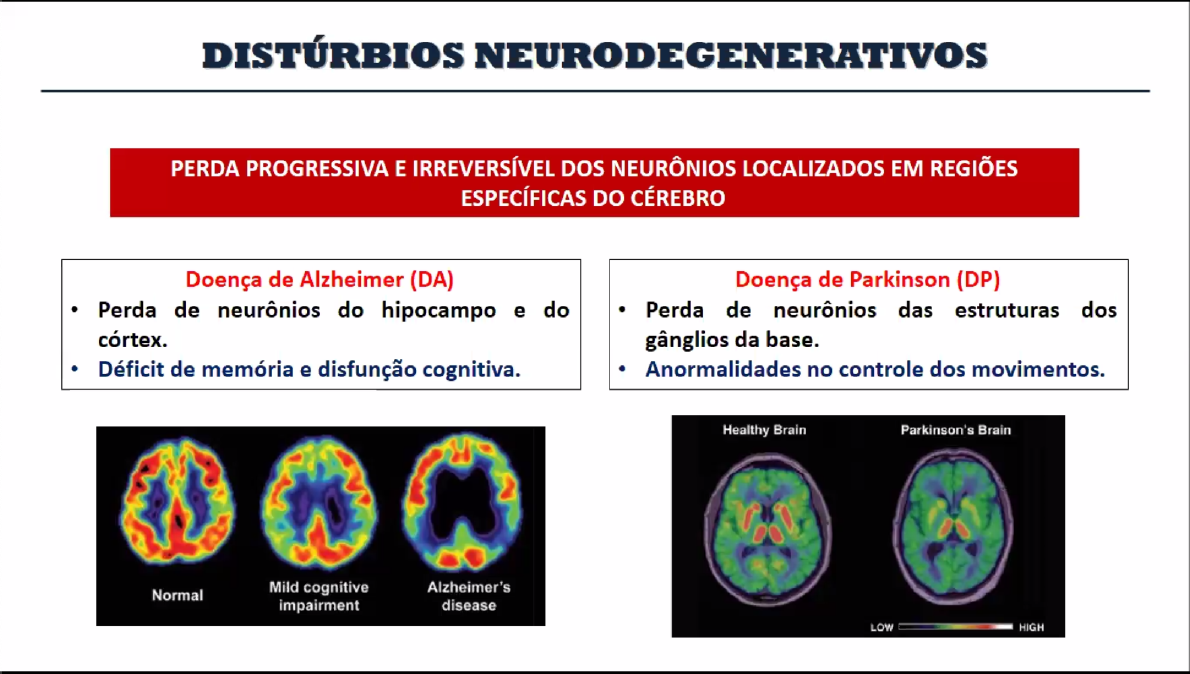 slide AULA 3 FARMACO - DOENÇAS DEGENERATIVAS - Farmacologia Geral slide AULA 3 FARMACO - DOENÇAS DEGENERATIVAS - Farmacologia Geral