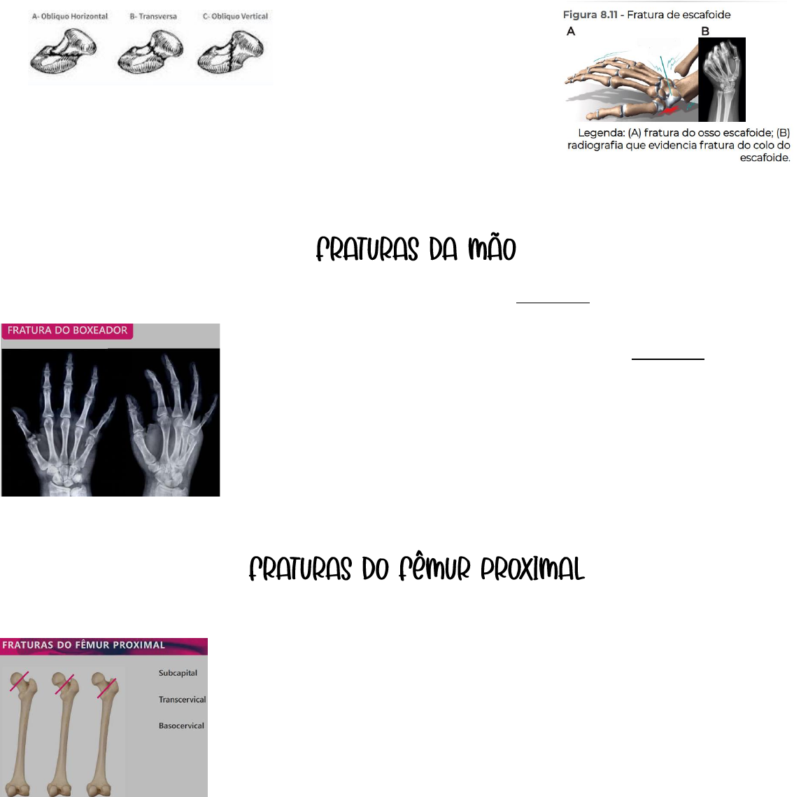 Fratura De Colles Reversa Fracture Of The Distal Radius: Epidemiology