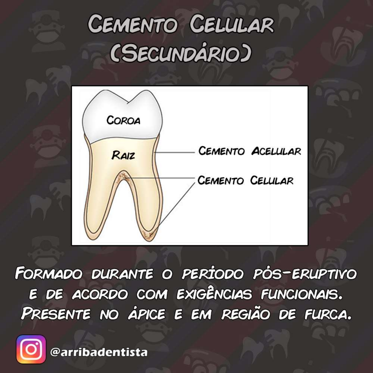 Classificação do Cemento Radicular - Cemento Celular e Acelular ...