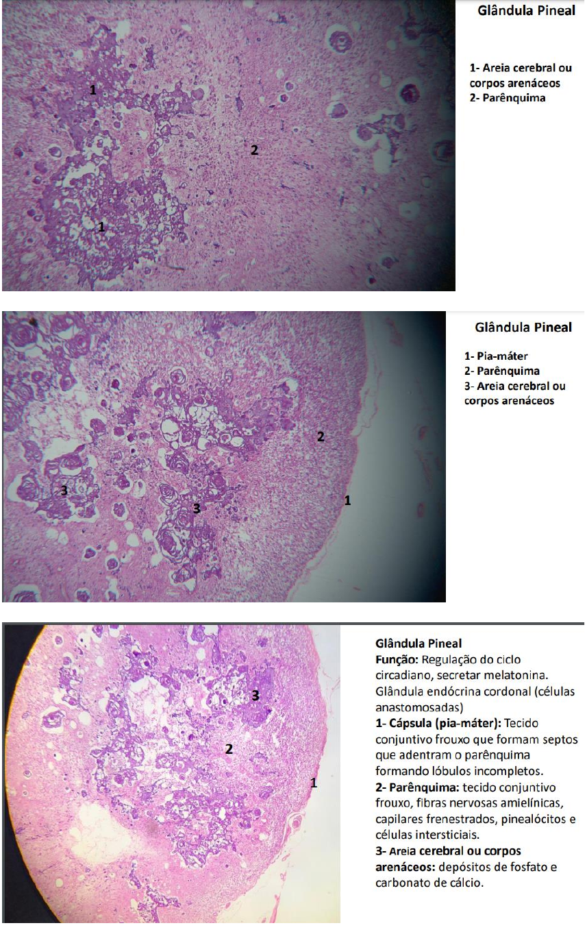 Histologia Da Glandula Pineal Anatomical, Scanning Electron