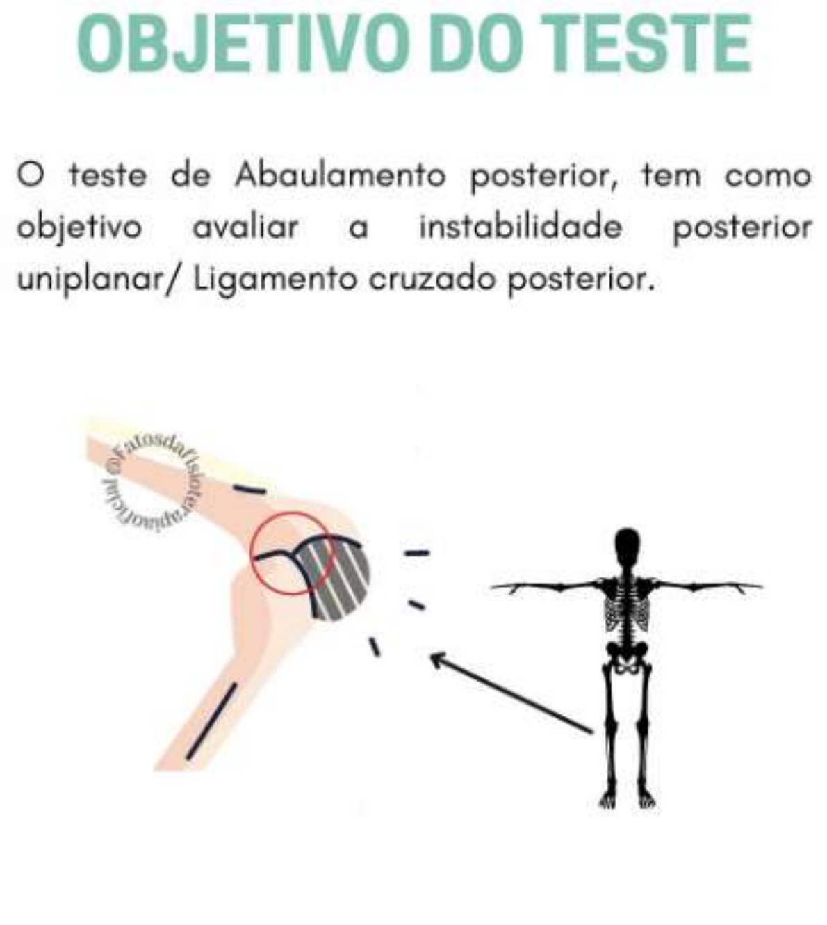 TESTE DE ABAULAMENTO POSTERIOR TESTE DE GAVETA POR GRAVIDADE.DEIXA SEU ...