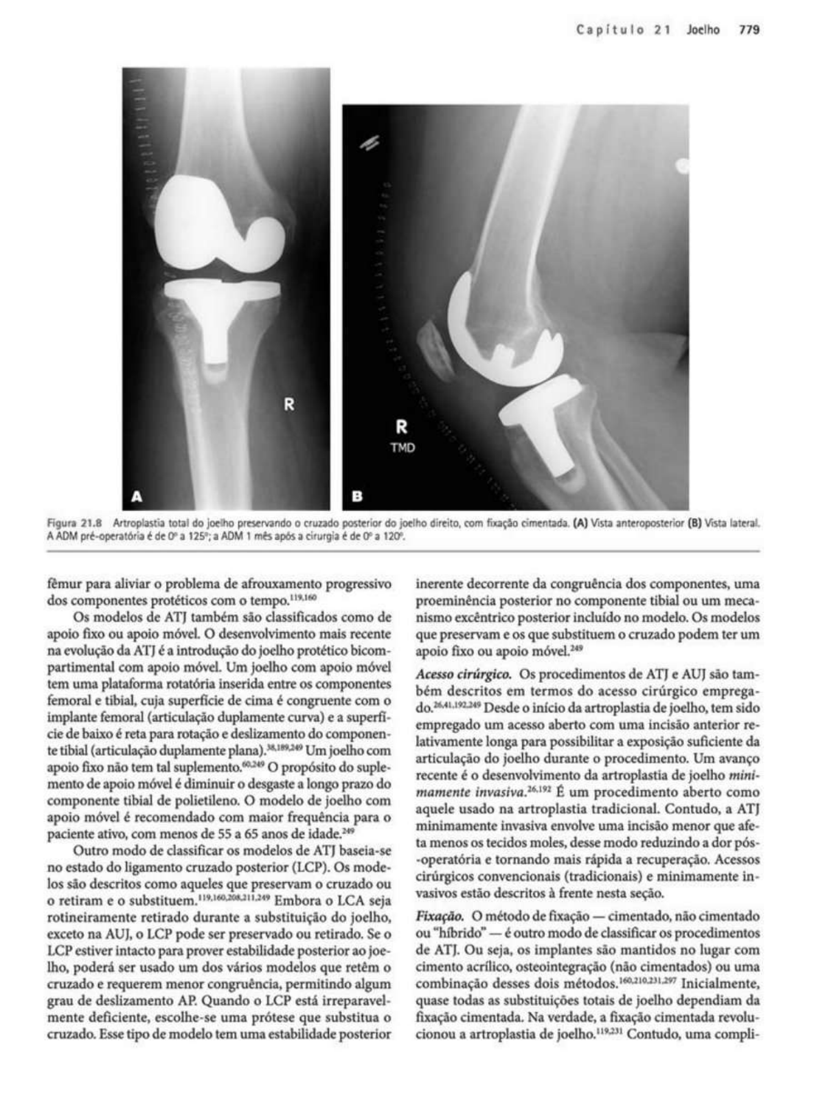 ATJ - Exercícios Terapêuticos Fundamentos e Técnicas 6Ed - Fisioterapia ...